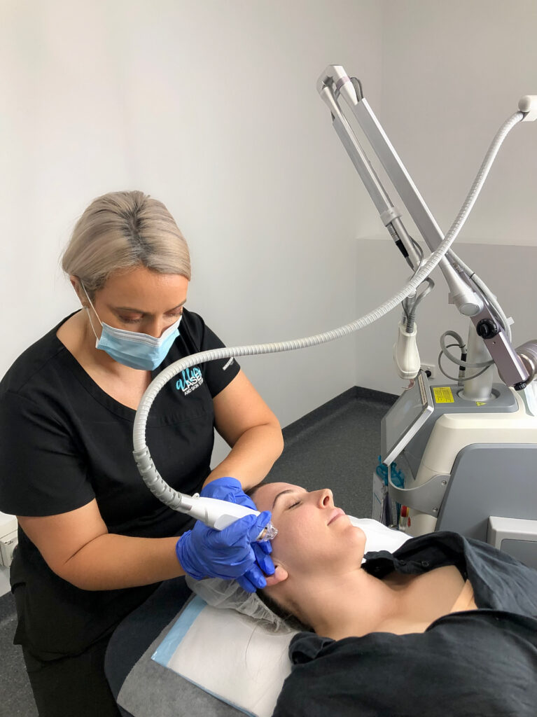 RF Skin Needling - Allure Clinic